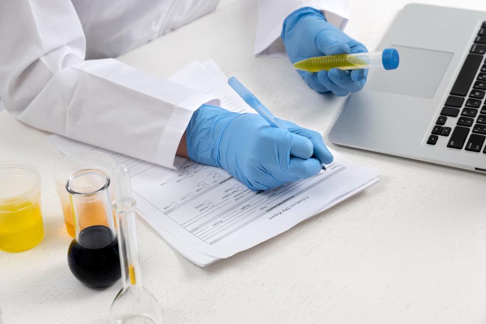 General Urinalysis - MyGenome